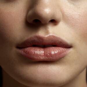 What is a Double Lip Line